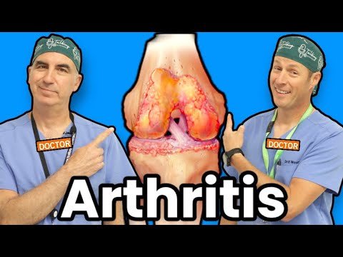 Treating Knee Arthritis Without Surgery Backpainheal